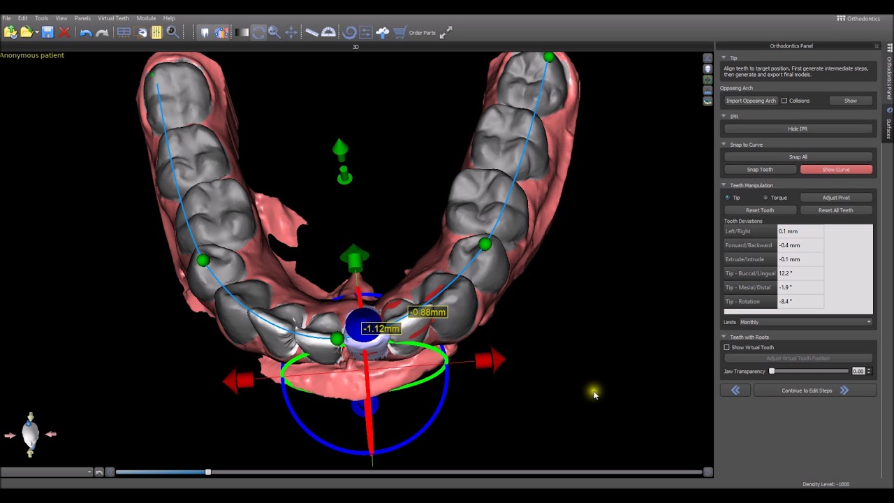 Beta Ortho Module Introduction Video - YouTube