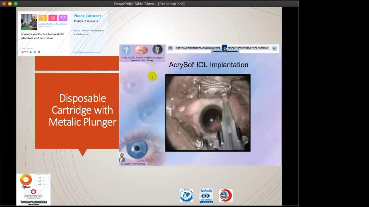 IOL implantation and Centration using different Injection systems - YouTube