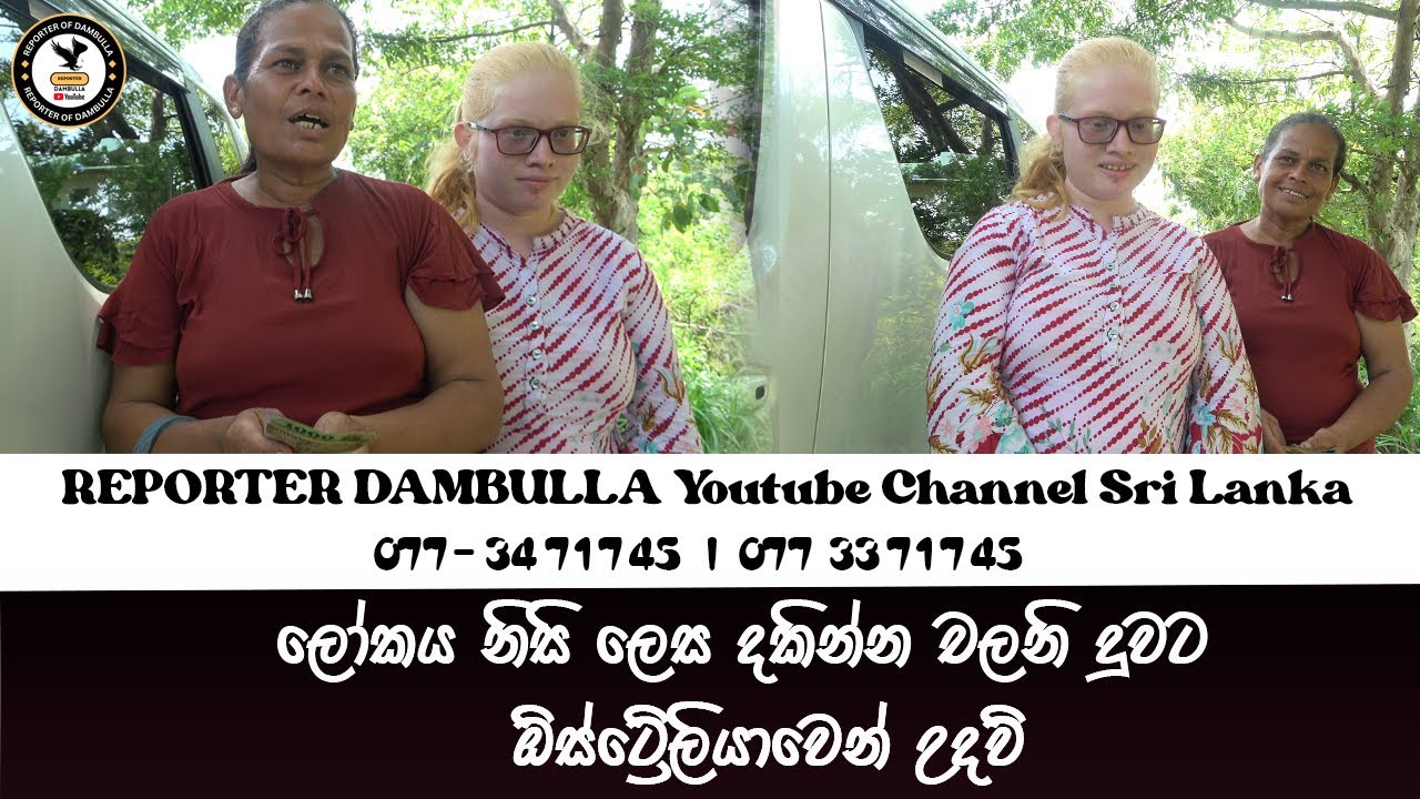 ලෝකය නිසි ලෙස දකින්න චලනි දුවට ඕස්ට්‍රේලියාවෙන් උදව් || Kumara ...