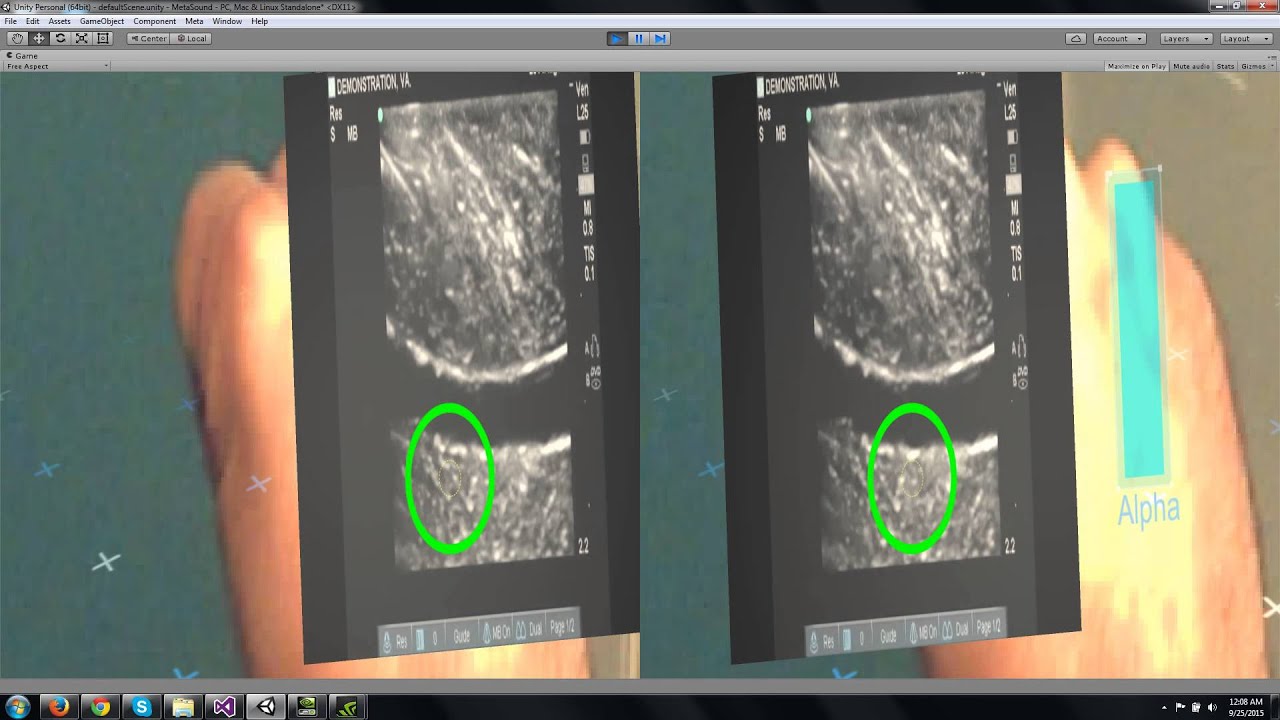 Meta Workshop Day 1 - Augmented Reality Ultrasound Application - YouTube