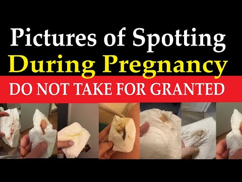 Pictures of Spotting During Pregnancy || If you notice them, kindly see ...