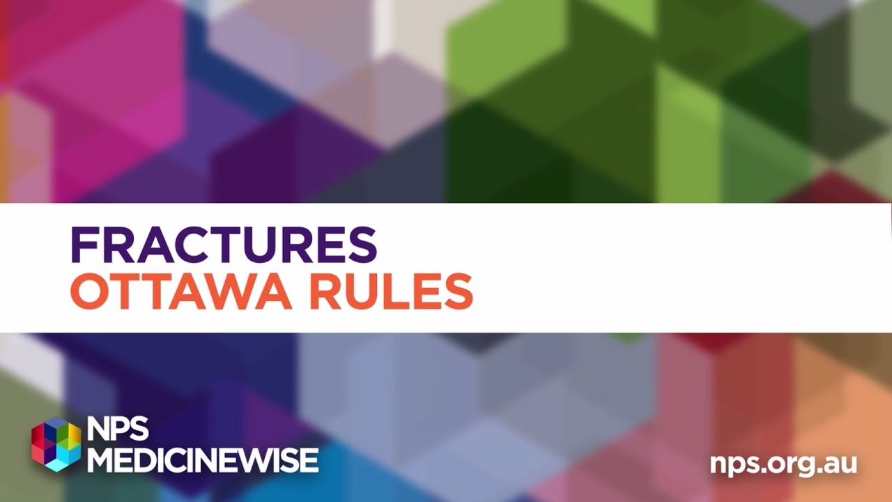 Ottawa Rules for ankle and knee injuries - YouTube