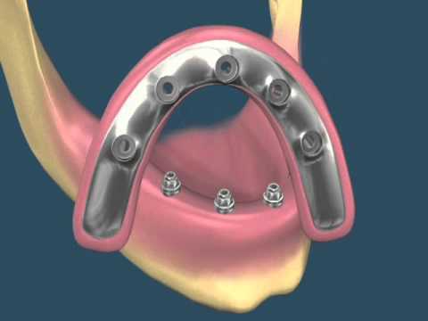PROTOCOLO INFERIOR - YouTube