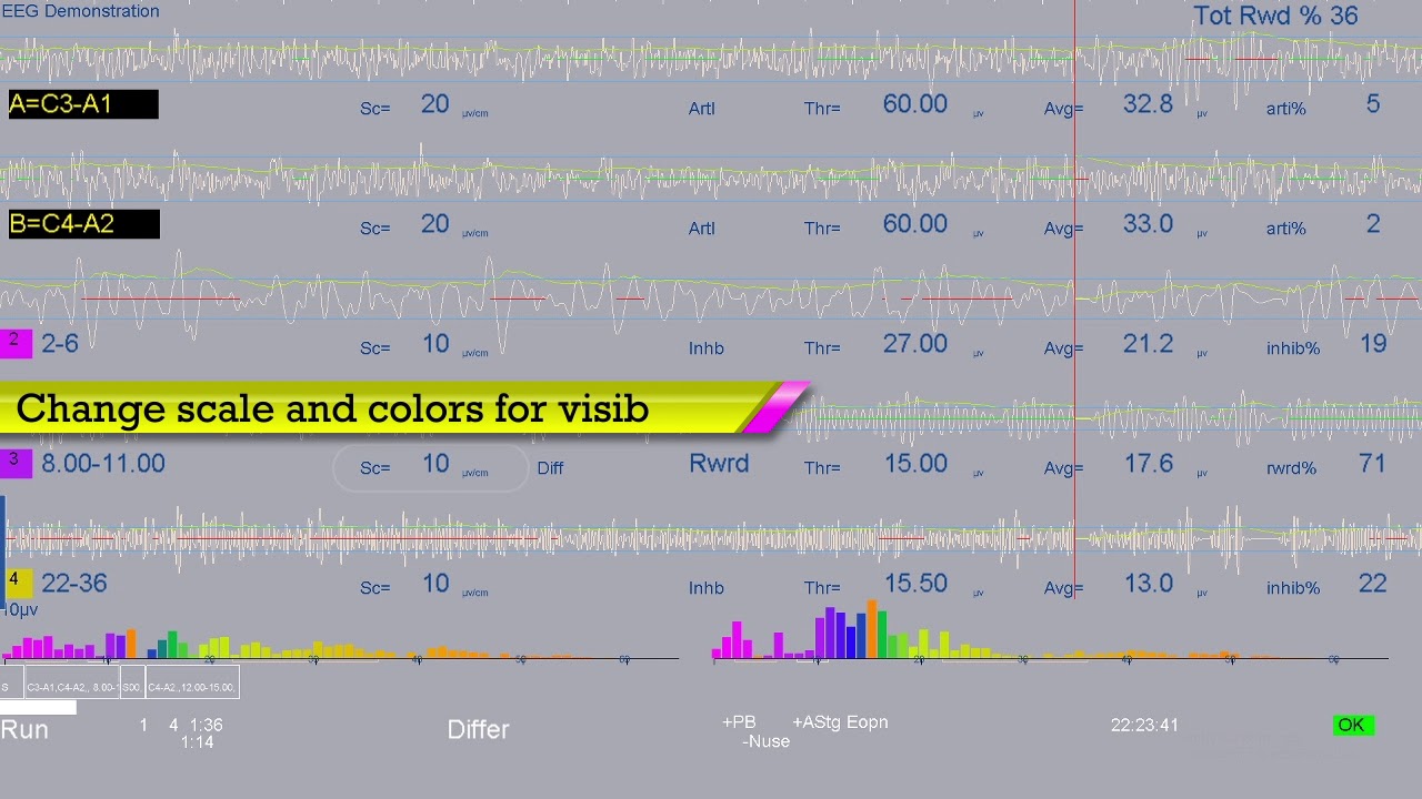 EEGer Neurofeedback Software – Therapist Wave Screen Overview | EEGer ...