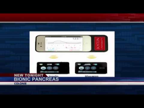 Bionic Pancreas is game changer for diabetics - YouTube