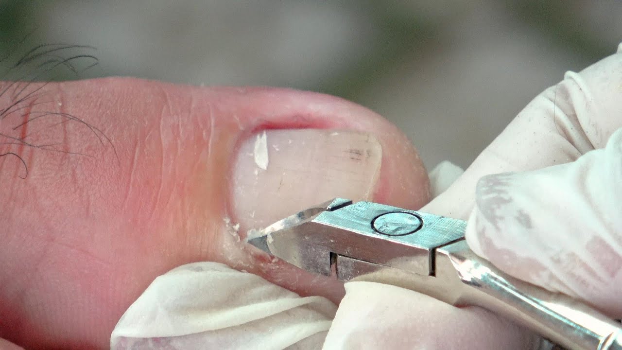 Clean dirty nails for relaxation - YouTube