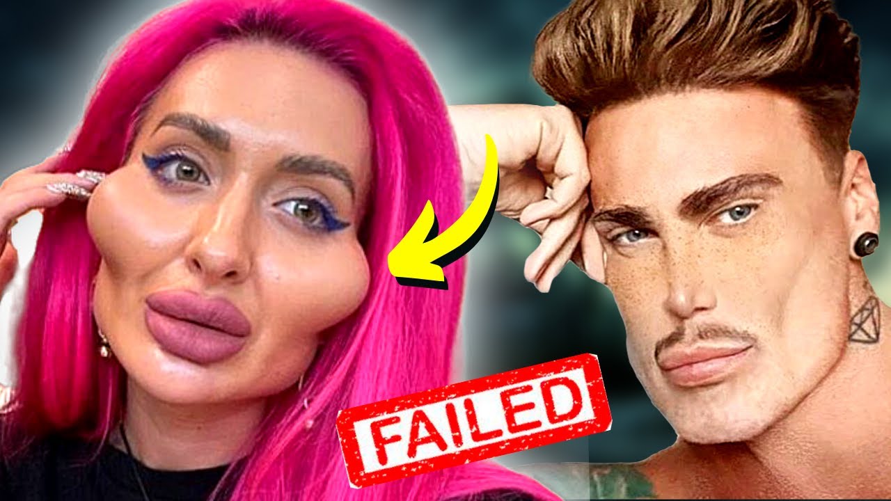 5 Times Plastic Surgery Went Horribly Wrong - YouTube