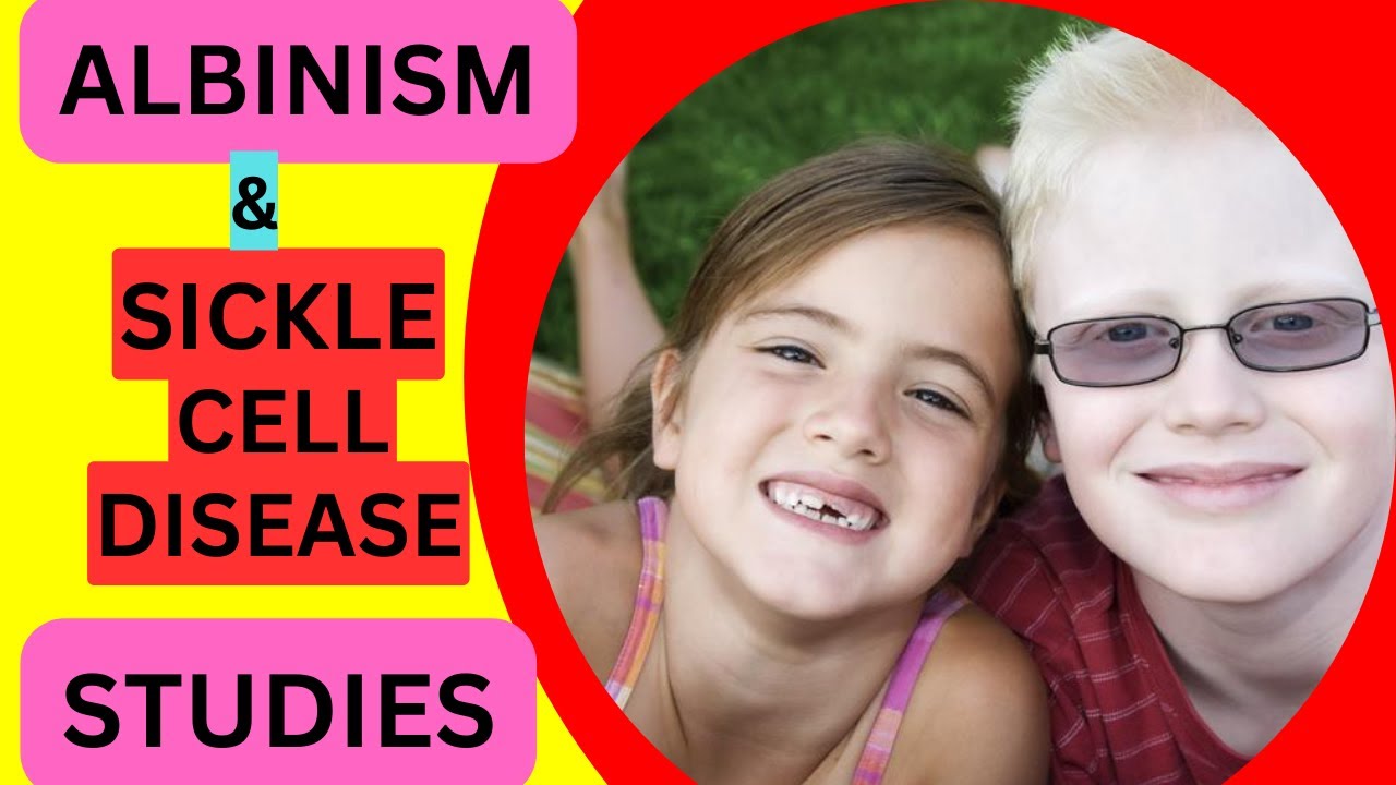 ALBINISM AND SICKLE CELL DISEASE COMPARATIVE STUDY - YouTube