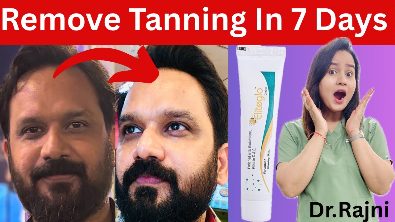 How To Use Eliteglo Cream To Remove Tanning In Just 7 Days | Doctor ...