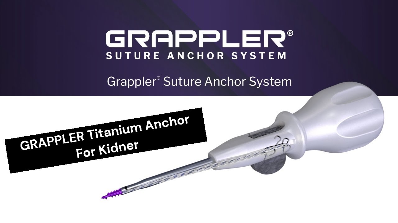 Paragon28 GRAPPLER Titanium Anchor for Kidner Procedure - YouTube