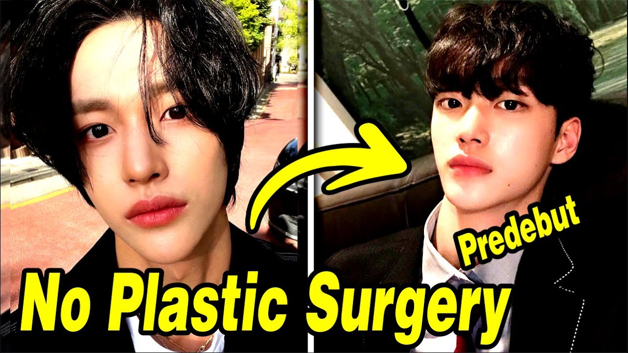 Shinee Plastic Surgery Before And After