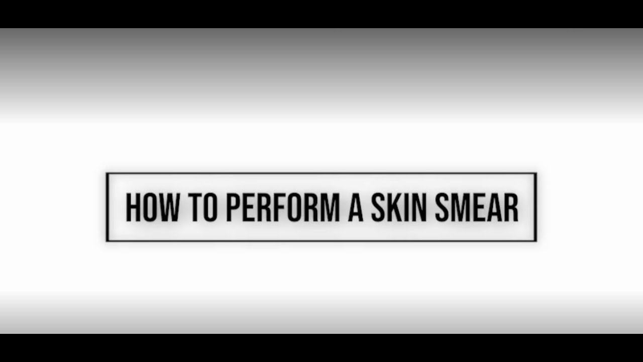 Leprosy Physical Exam - Skin Smear - YouTube