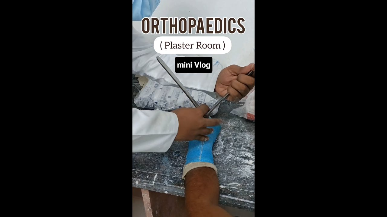 ORTHOPAEDIC Plaster room Posting | mini vlog | A day in an INTERN's ...