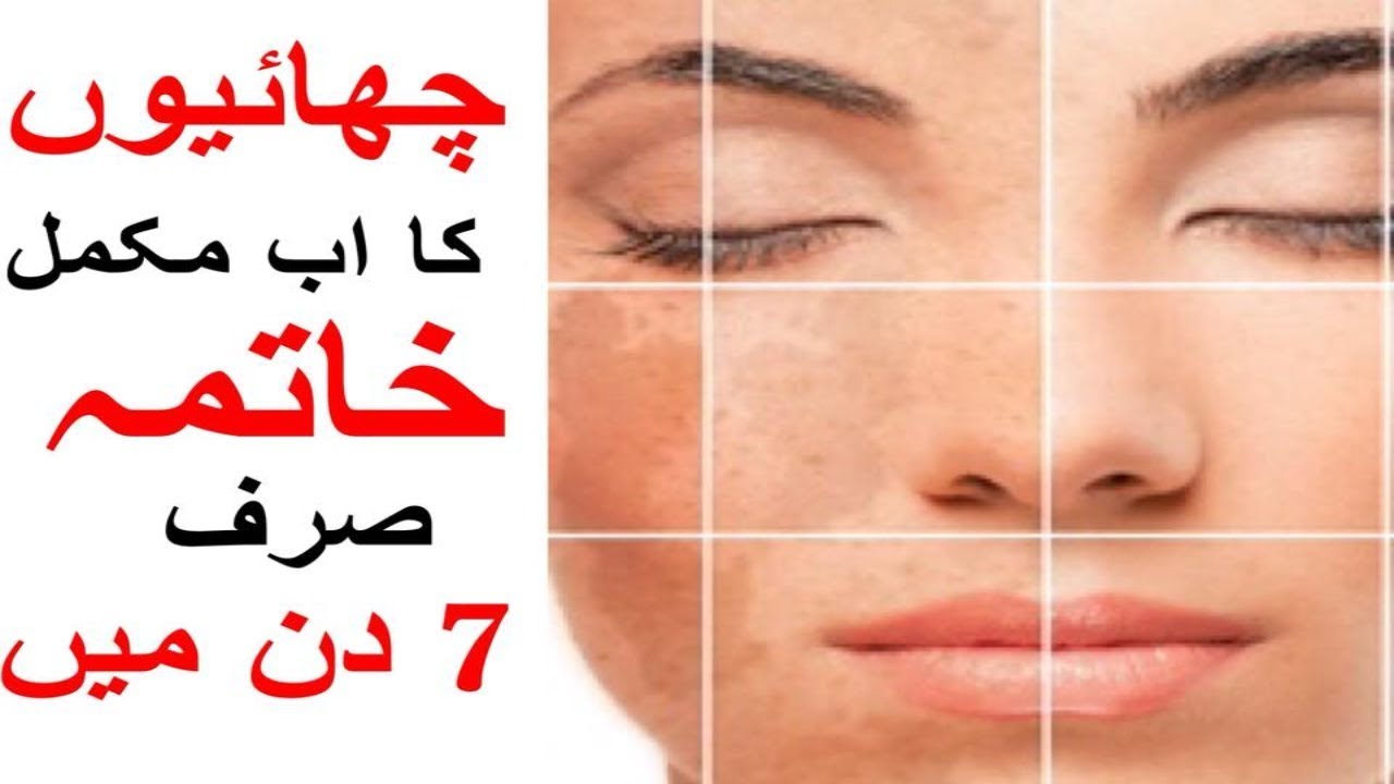 Remove Face Pigmentation Dark Spots Browns Spots 100 Effective In Urdu remove-face-pigmentation-dark-spots-browns-spots-100-effective-in-urdu