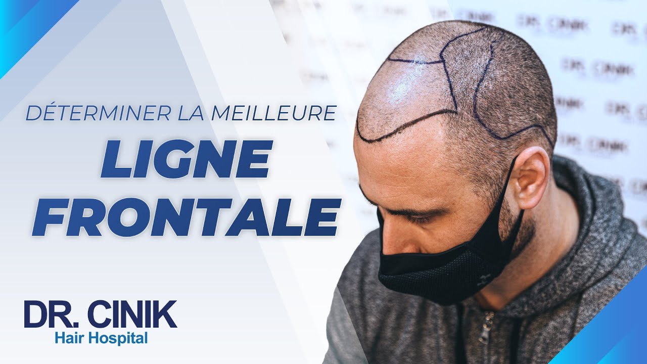 Déterminer la meilleure ligne frontale | Dr.Cinik - YouTube