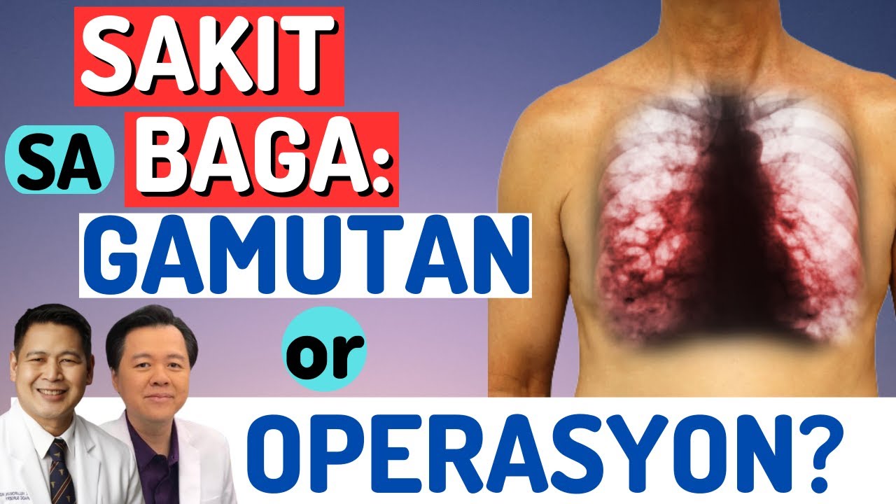 Sakit sa Baga: Gamutan or Operasyon? - by Dr. Ed Villaroman at Doc ...