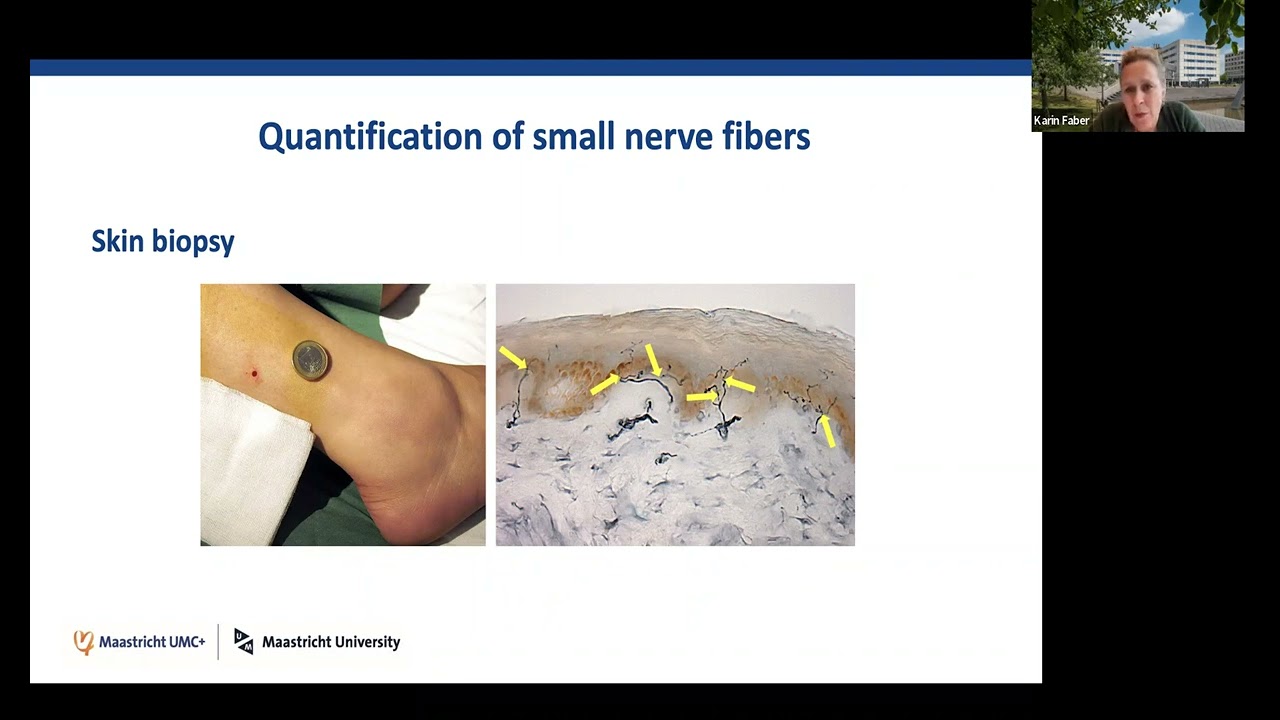 Nerve Fibers In Skin