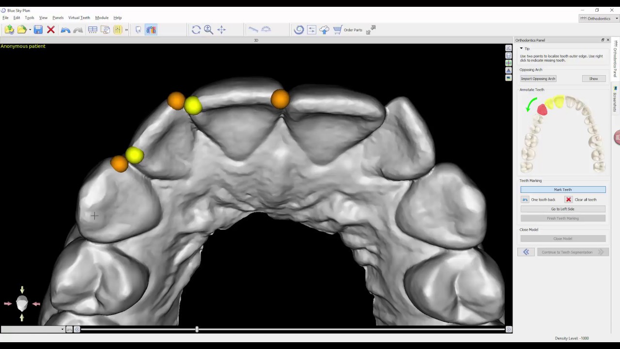 Phase 2 - Model Orientation and Tooth Selection - YouTube