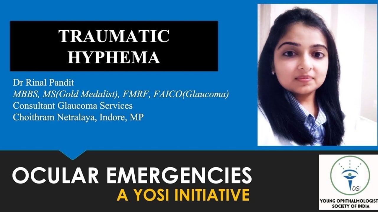 Traumatic Hyphema | Dr Rinal Pandit | YOSI Ocular Emergency | Episode 9 ...