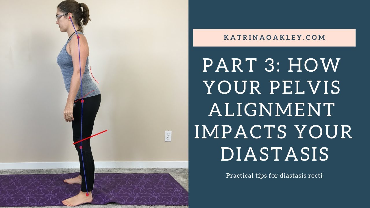 Pelvis alignment and lower diastasis - YouTube