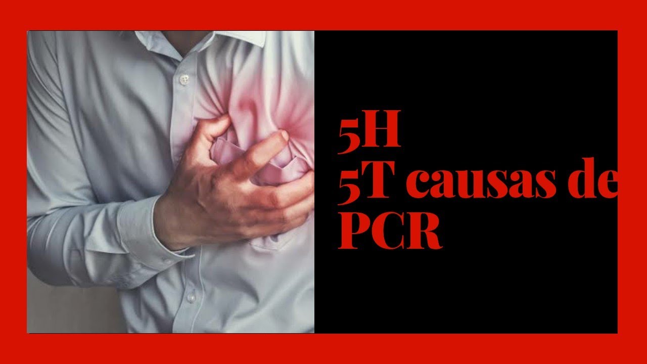 Parada Cardiorrespiratória - Causas Reversíveis de PCR 5H 5T - Dica ...