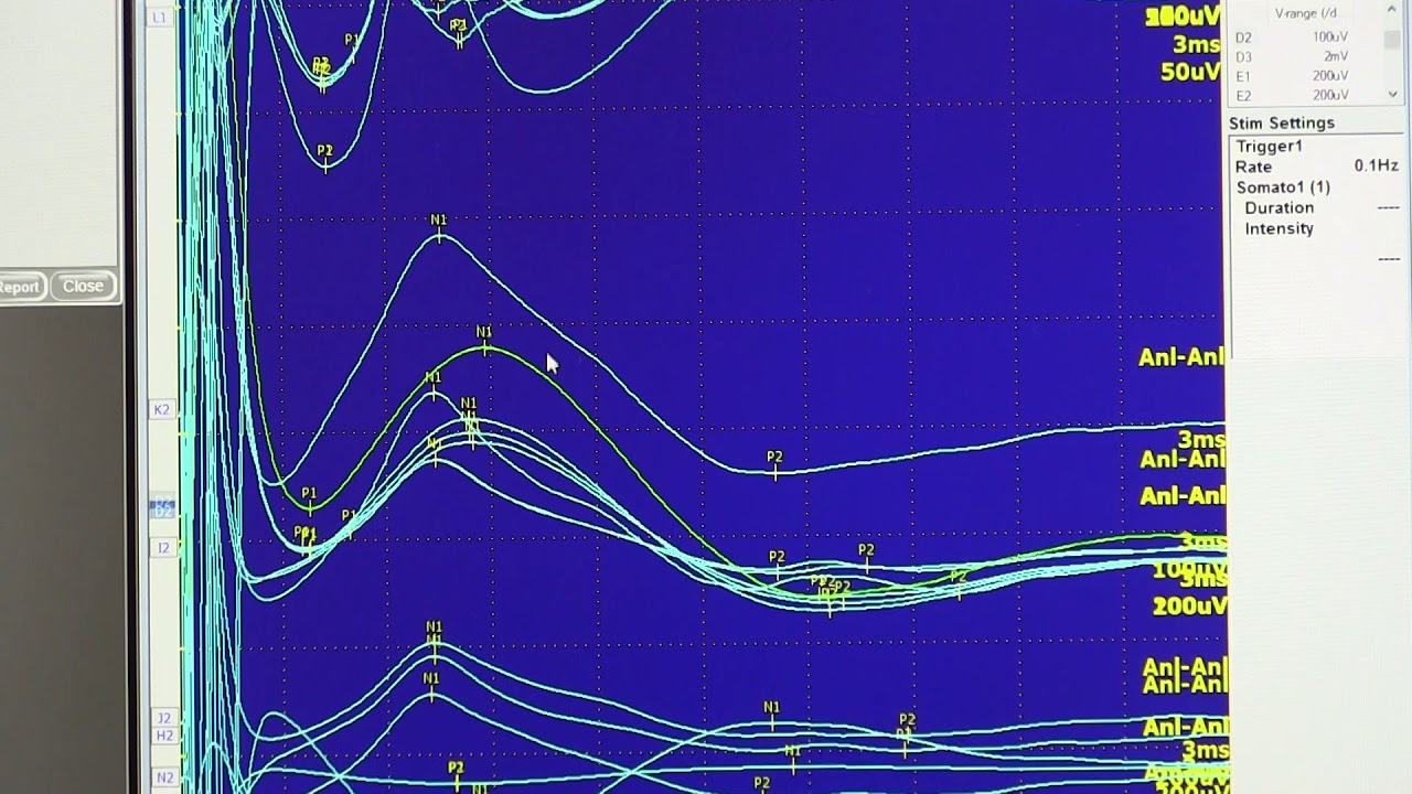 TAMS 6- Measurement/Interpretation Process - YouTube