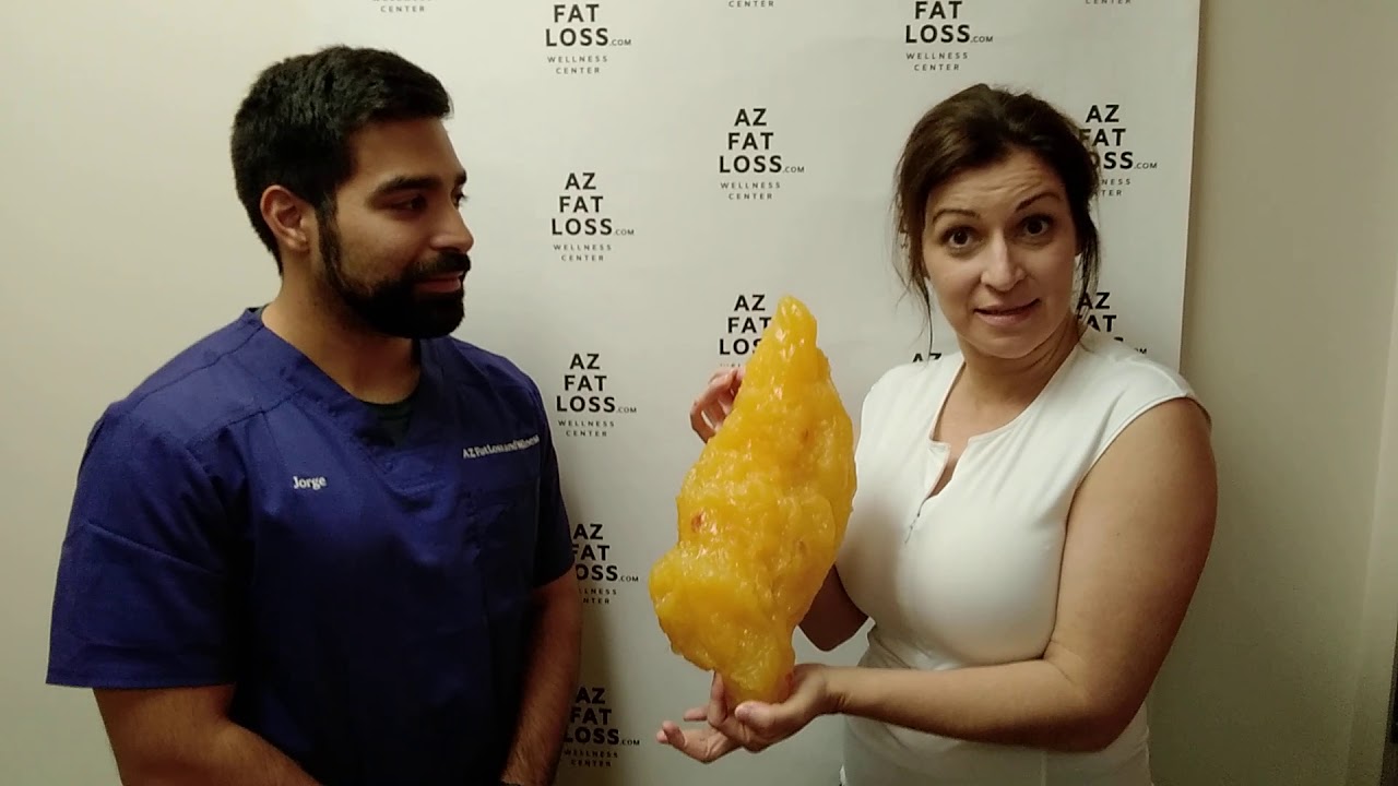 Carrie Fat Loss - YouTube