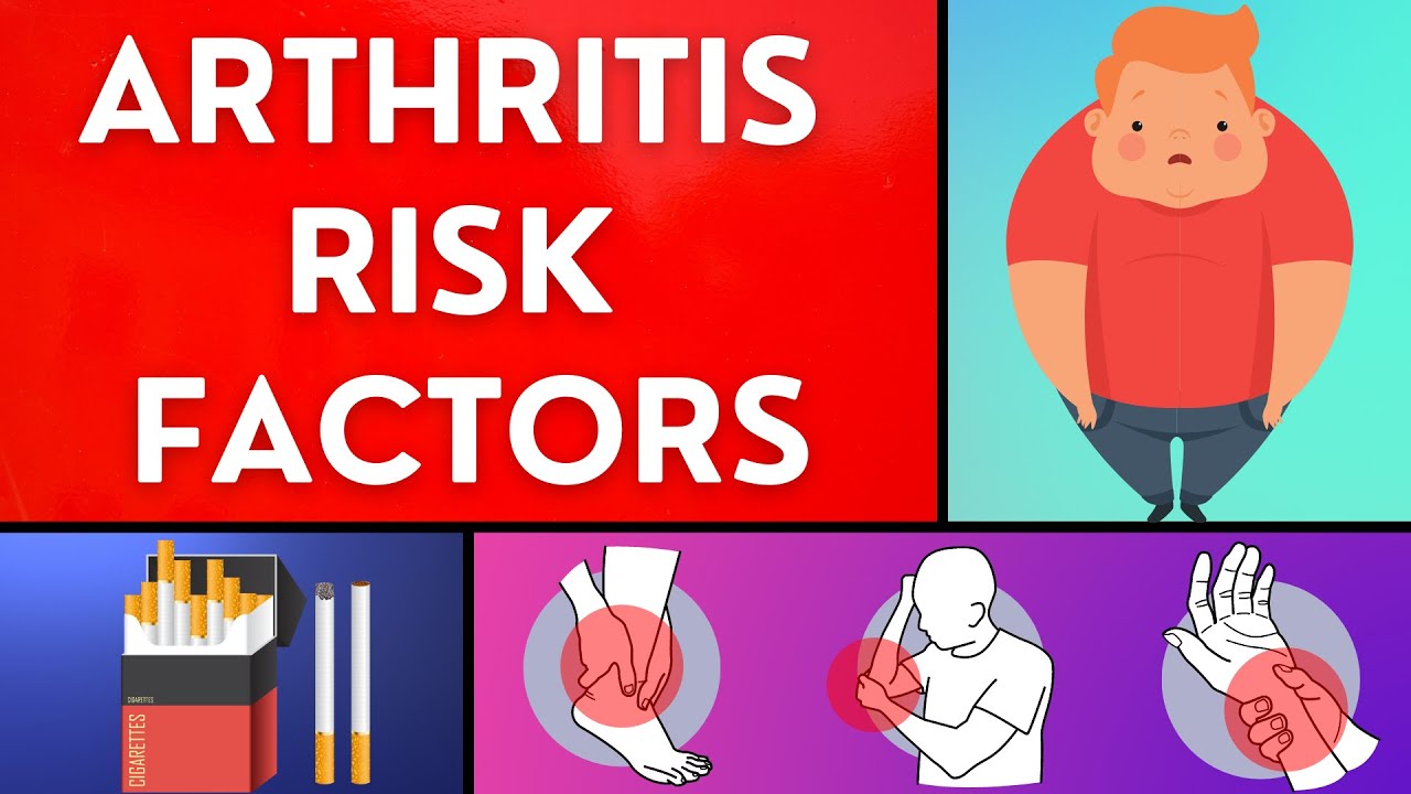 Be Careful about These Developing Arthritis Risk Factors - YouTube