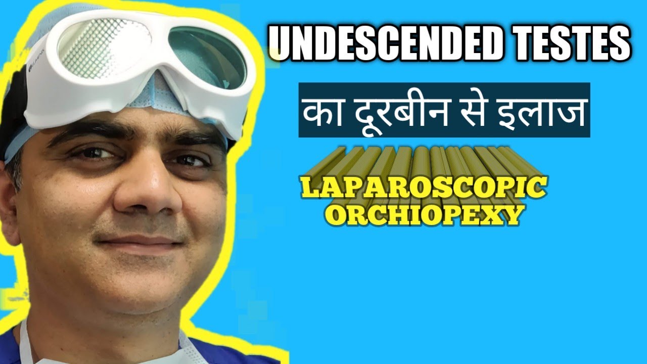 laproscopic orchiopexy in undescended testes.Undescended testicle ...
