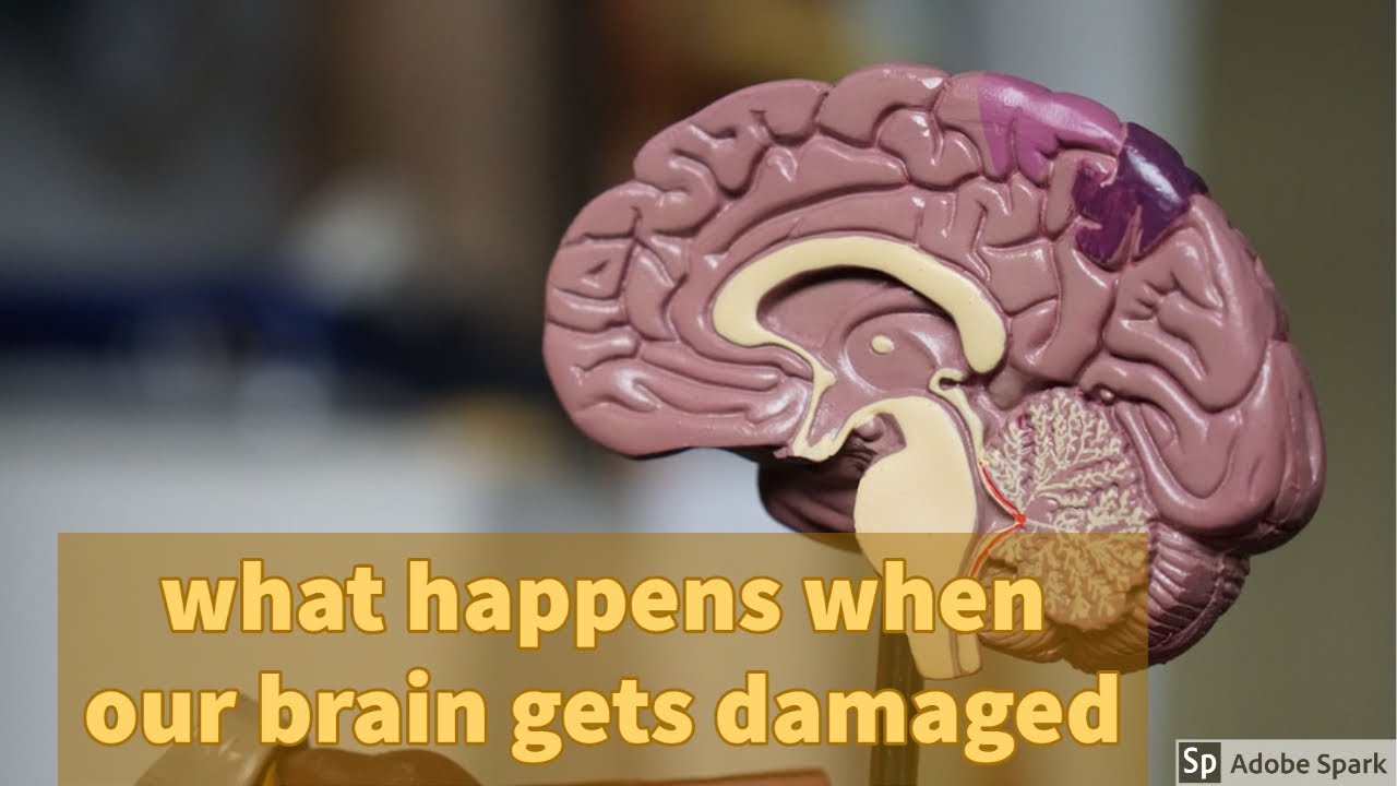 What happens When Our brain gets damaged - YouTube