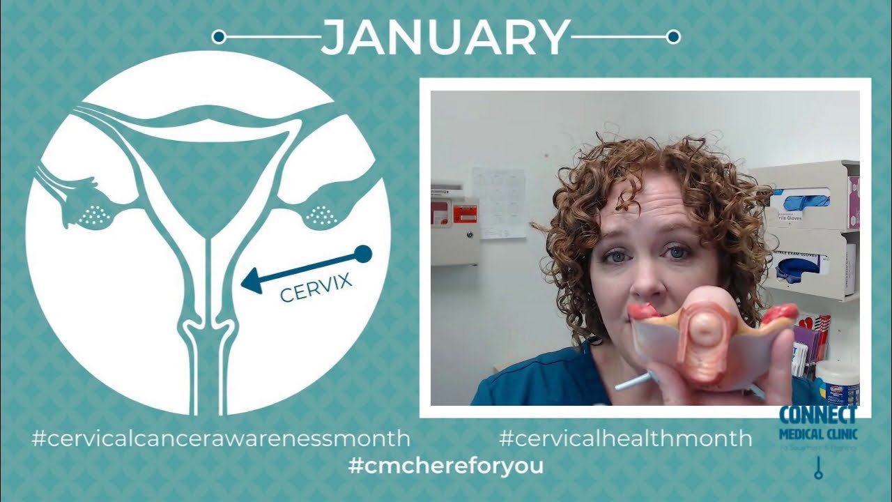 Staff Minute: Healthy Cervix Awareness: Part 1 - YouTube