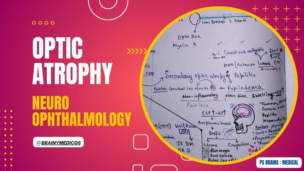 7. Neuro Ophthalmology | Optic Atrophy | Eye | MBBS | @BrainyMedicos ...