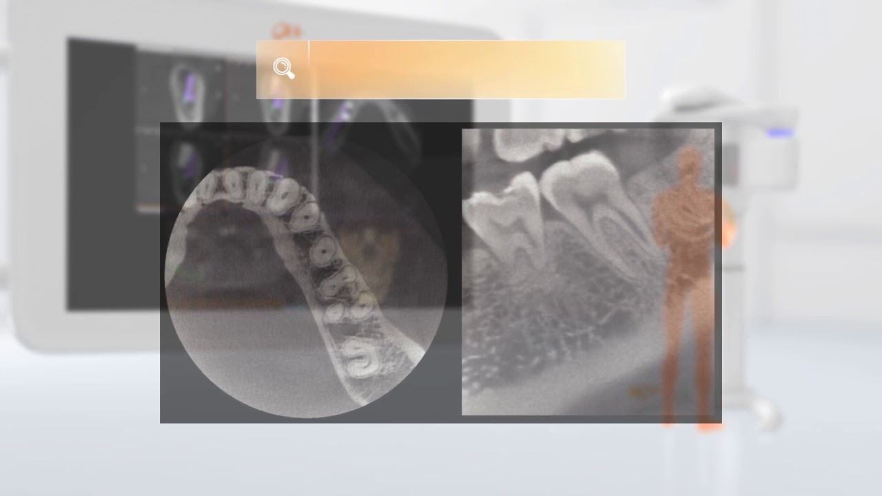 Panoramic , ceph, CBCT - YouTube