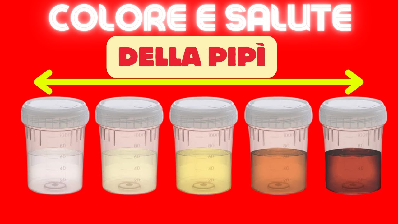 Cosa dice il colore delle urine sulla tua salute . Guasto del sistema ...