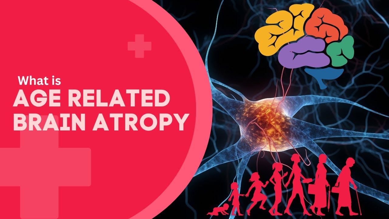 Unlocking the Secrets of Age-Related Brain Atrophy: Preserving ...