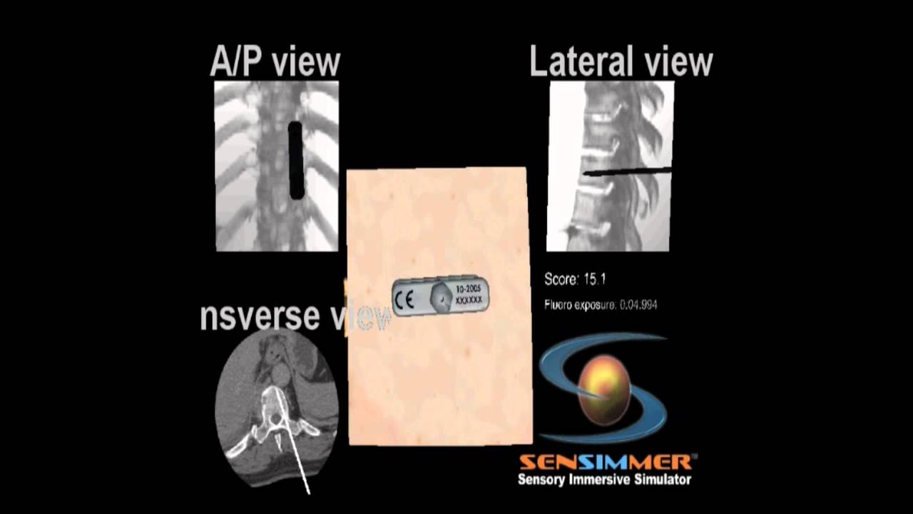 Spinal Fixation Simulation VR Haptics - YouTube