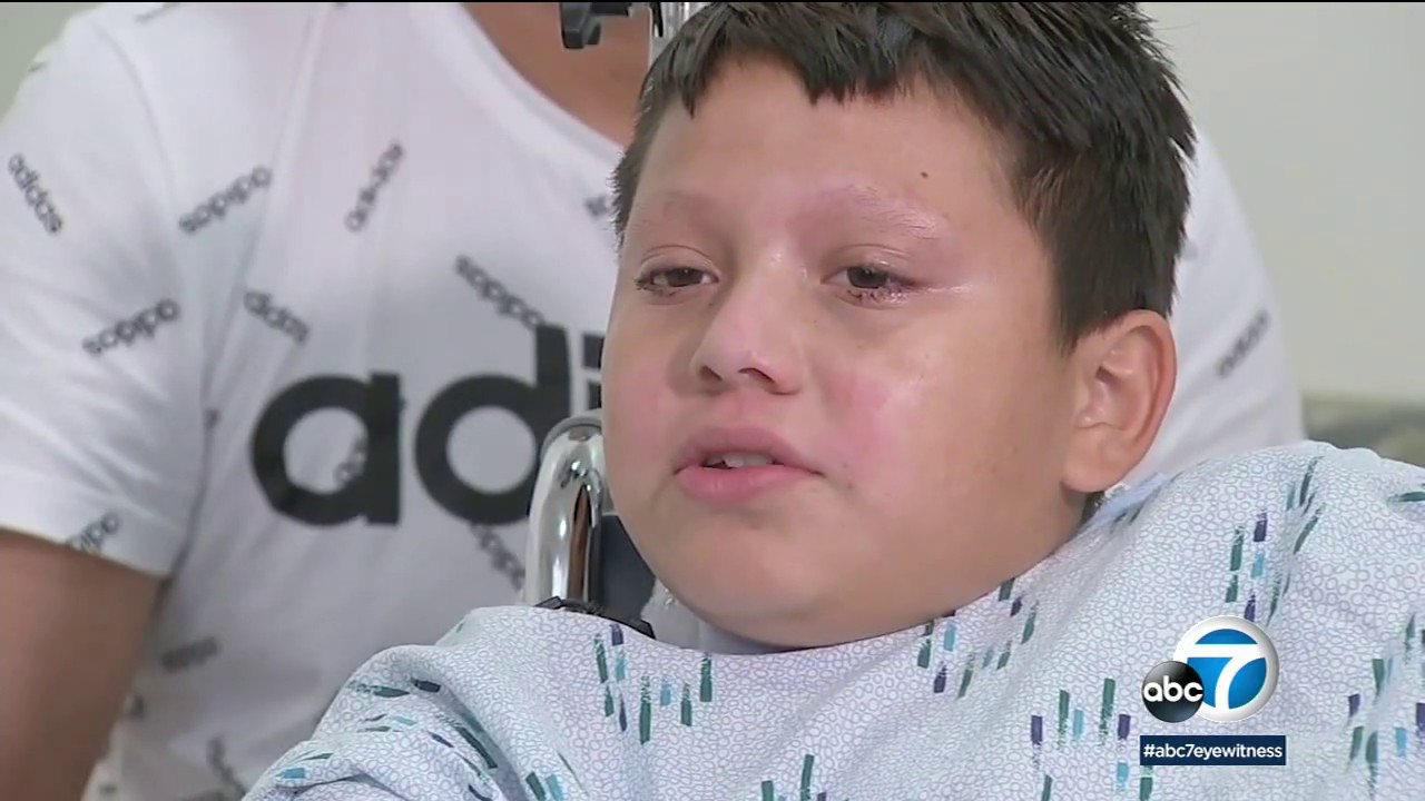 Compton amputee, 10, has endured 5 surgeries since neighbor handed him ...