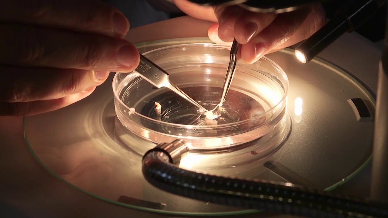 How to make a stylet prep - YouTube