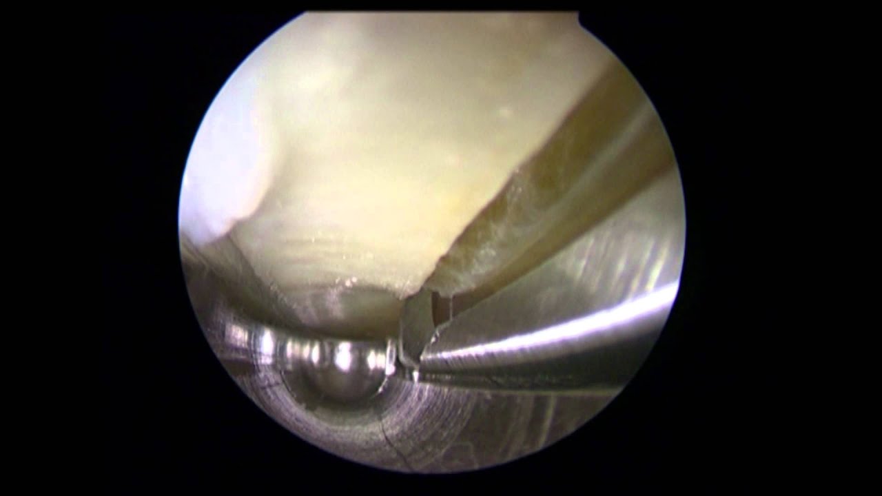 SegWAY ECTR Field of View - YouTube