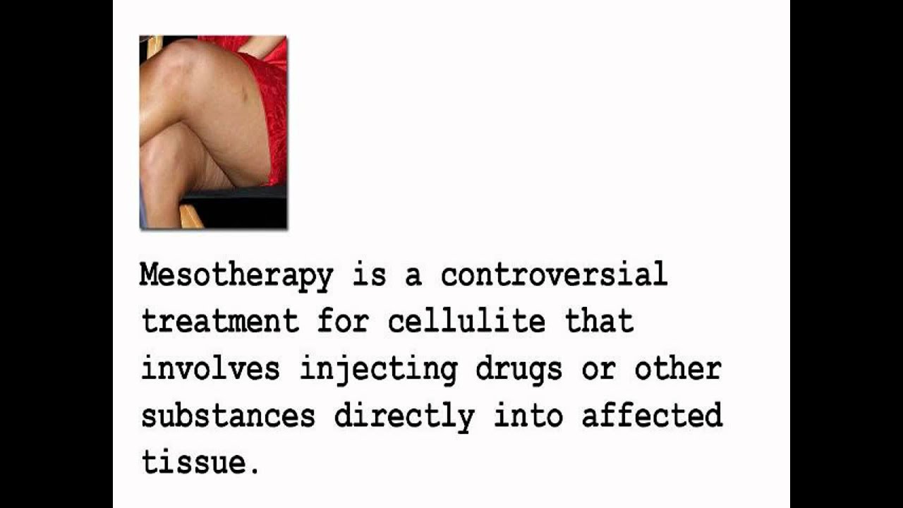 Cellulite In Children - YouTube