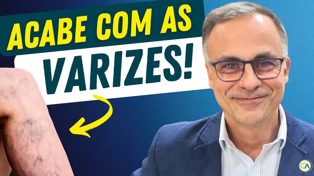 VARIZES: 7 MELHORES ALIMENTOS - YouTube