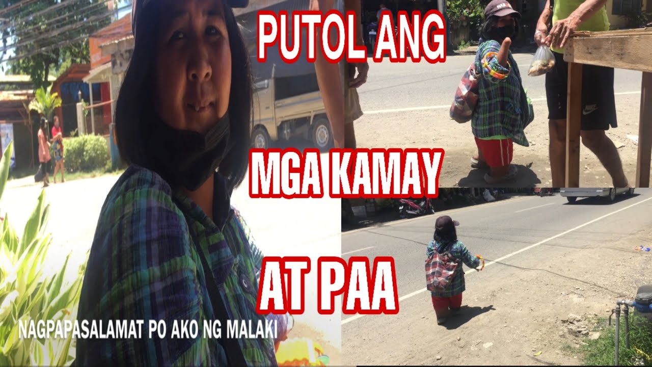 PUTOL ANG MGA KAMAY AT PAA - YouTube