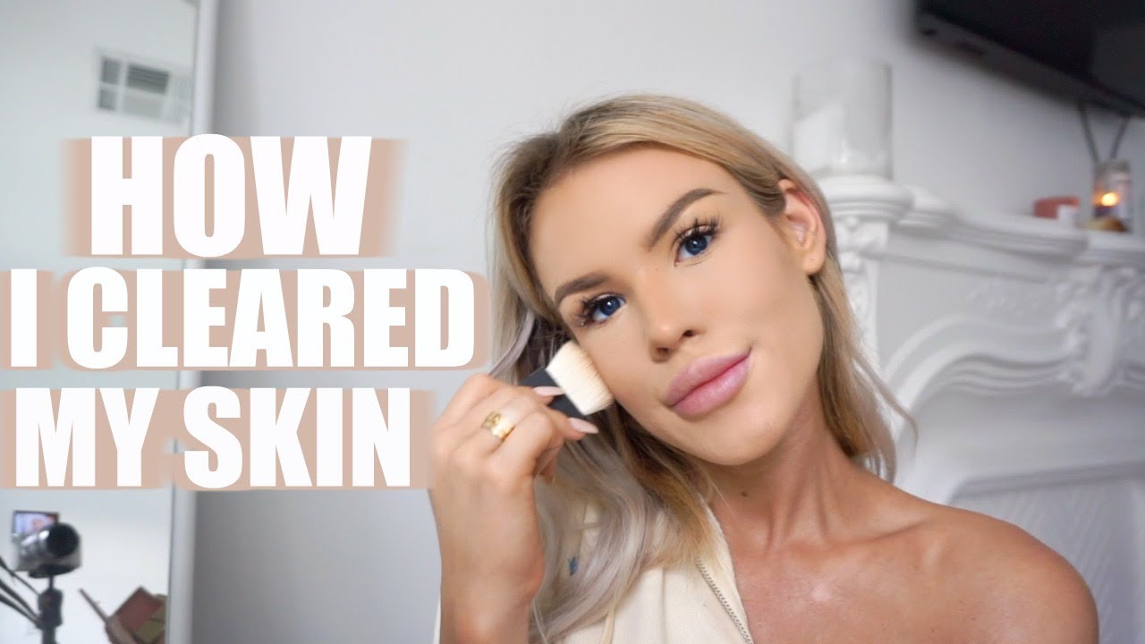 How I Cleared My Skin Youtube