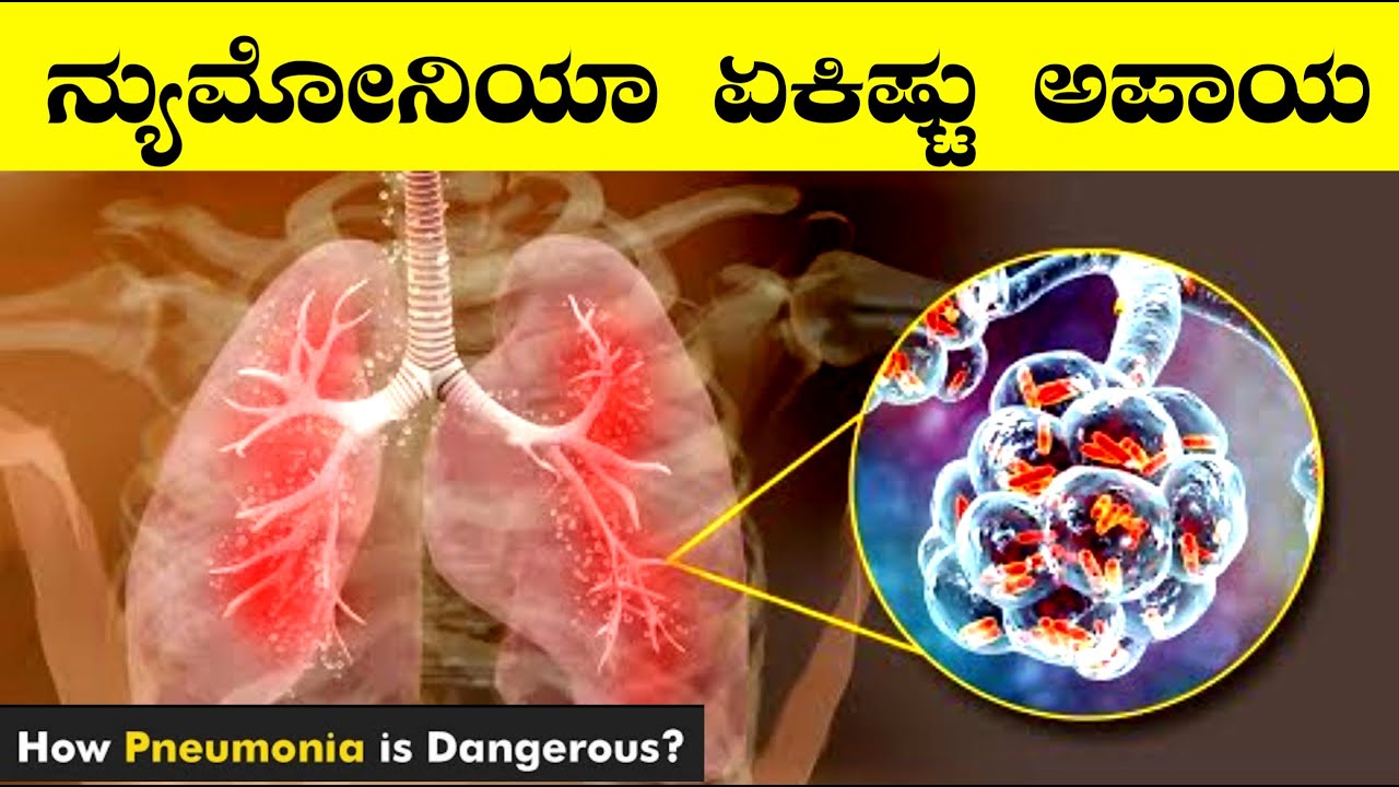 Why is pneumonia so dangerous? | What Happens in Pneumonia? | Symptoms ...
