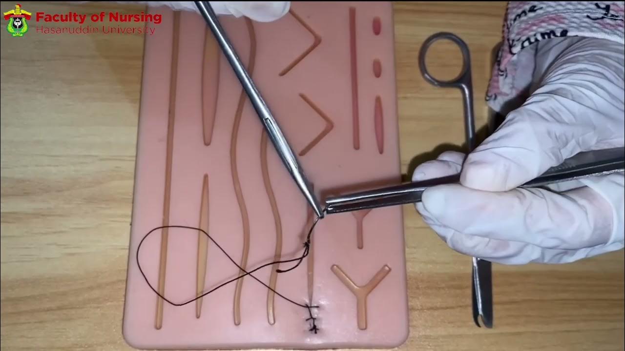 Teknik Suturing Simple Running Locking Suture Youtube
