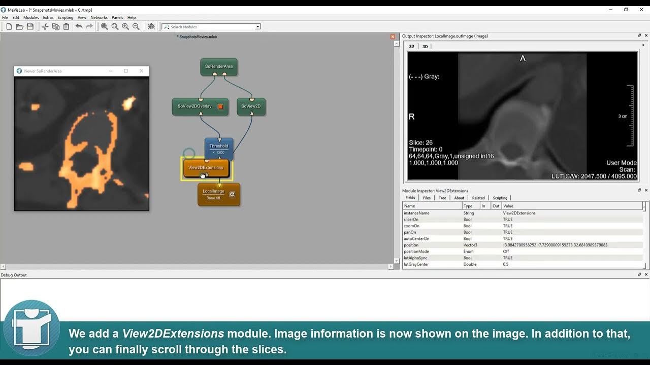 MeVisLab Tutorials - Visualization - Snapshots and Movies - YouTube