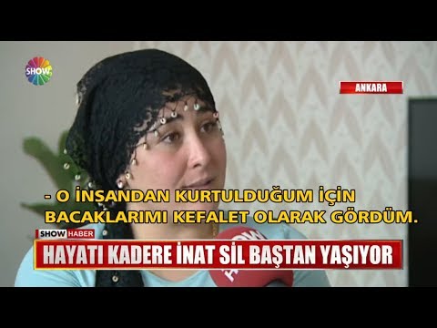 Hayatı kadere inat sil baştan yaşıyor