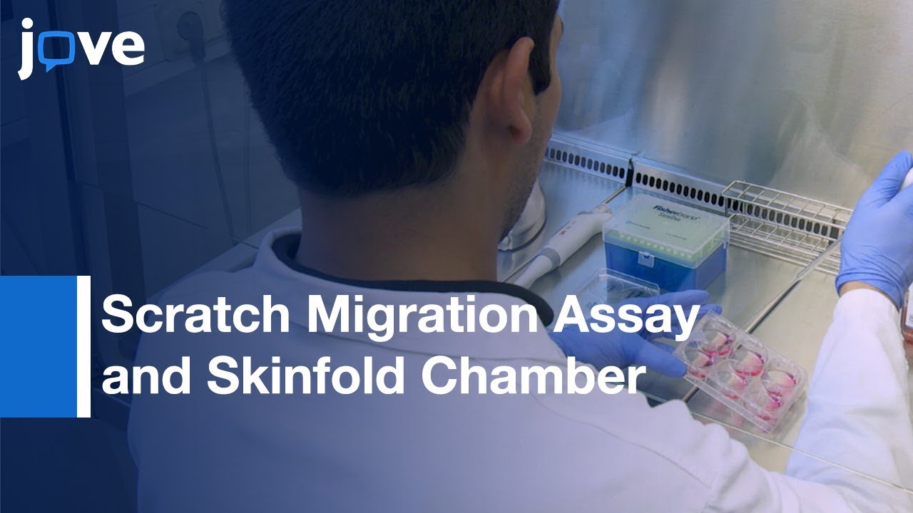 Scratch Migration Assay and Skinfold Chamber: Wound Healing Analysis ...