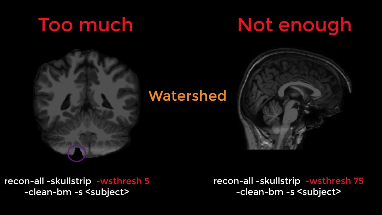 FreeSurfer #13: SkullStripping and Pial Surface Errors - YouTube