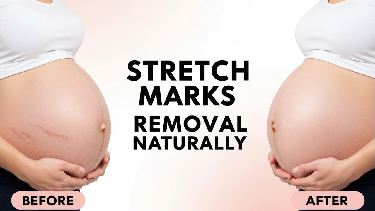 Full Body Smooth 🚫 No STRETCH Marks 100% Natural Hacks 🌸 DIY - YouTube